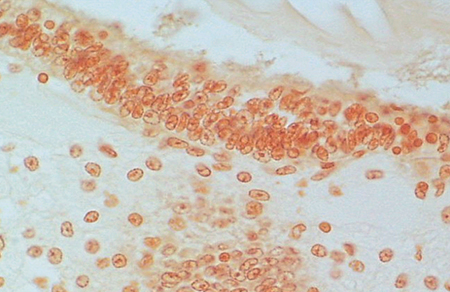 Diagnostic profile of Belize Taura Syndrome Virus - Responsible Seafood ...