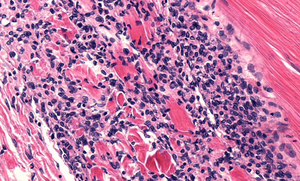 Infectious myonecrosis: New disease in Pacific white shrimp ...