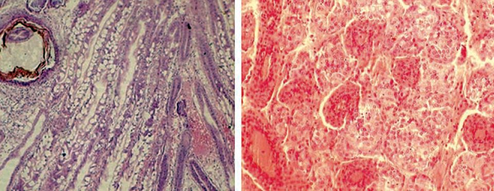 Loose shell syndrome causes low-level mortality in India's black tiger ...