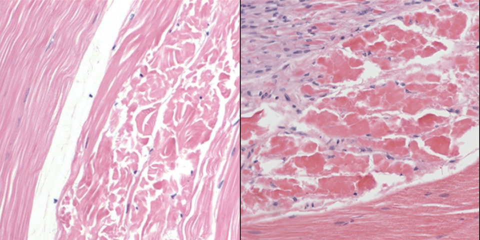White tail disease in shrimp mimics infectious myonecrosis ...