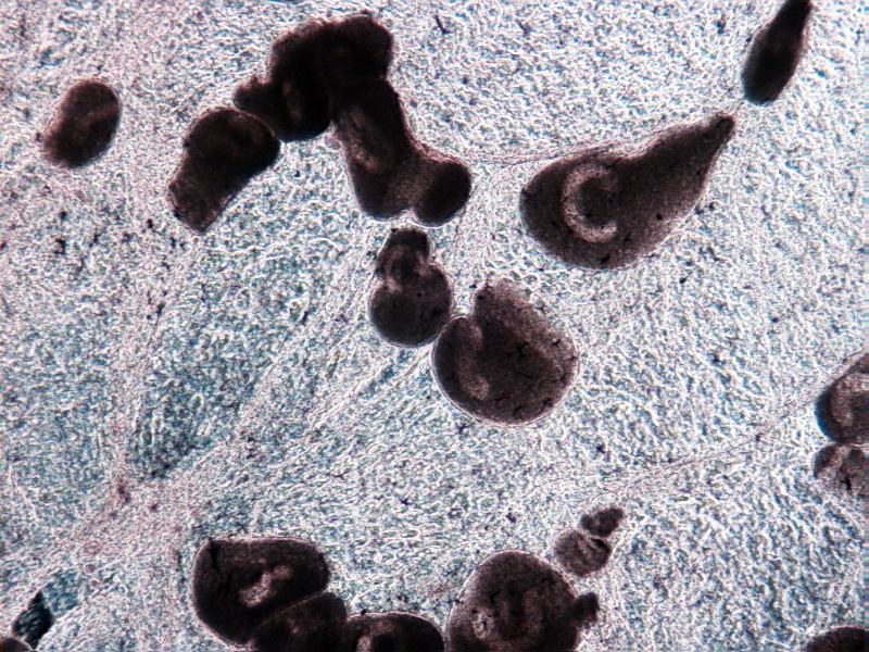 Antigens provide immunity against ich in channel catfish trials ...