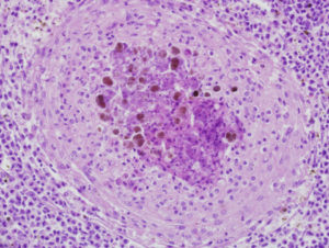 Bacterial diseases cause granulomas in fish - Responsible Seafood Advocate