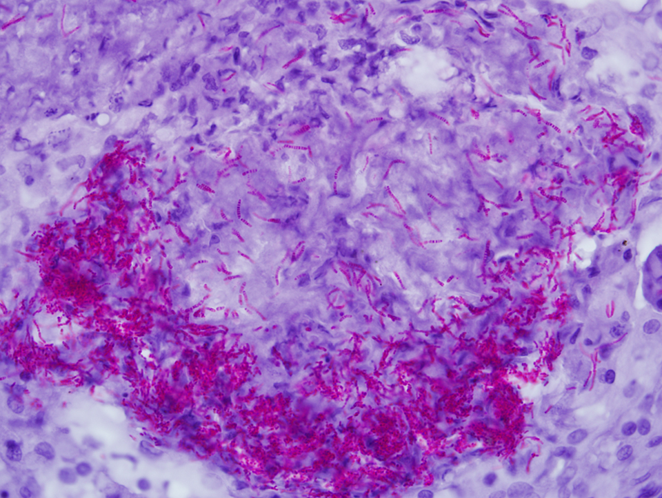 Bacterial diseases cause granulomas in fish - Responsible Seafood Advocate