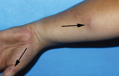 Working with fish, limiting zoonotic diseases - Responsible Seafood ...