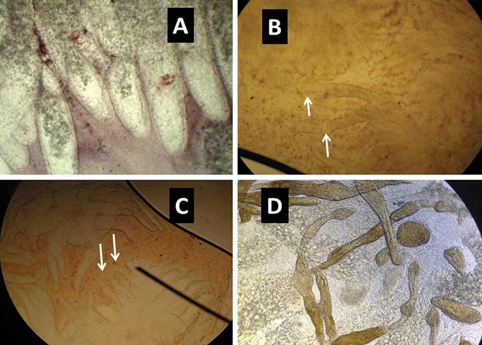 Hepatopancreas colors predict survival of shrimp to EMS - Responsible ...