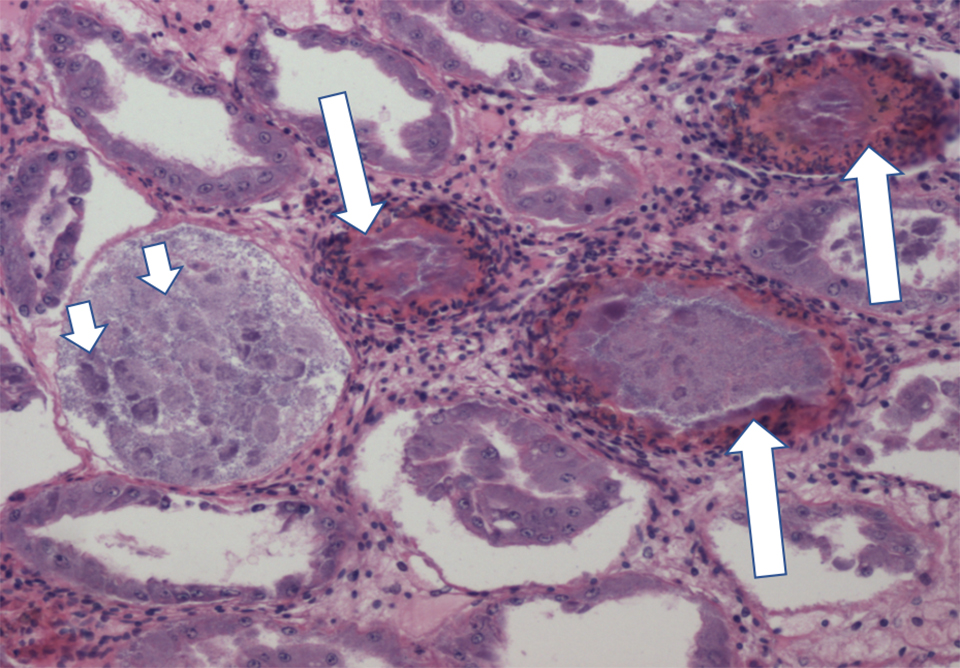 Development of new and real-time PCR for detection and quantification ...