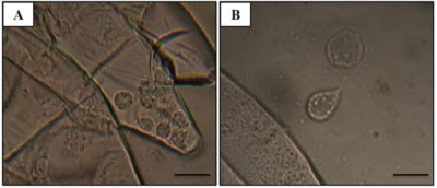 Detection of an amoebic parasite in cultured Paciﬁc white shrimp ...