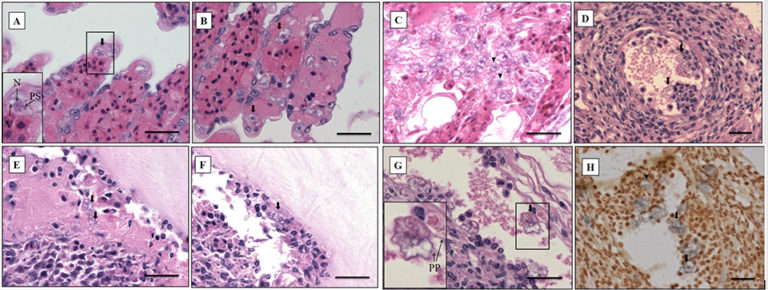 Detection of an amoebic parasite in cultured Paciﬁc white shrimp ...