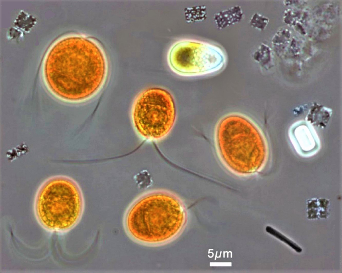 Potential for production of highly valuable PUFAs from microalgae ...
