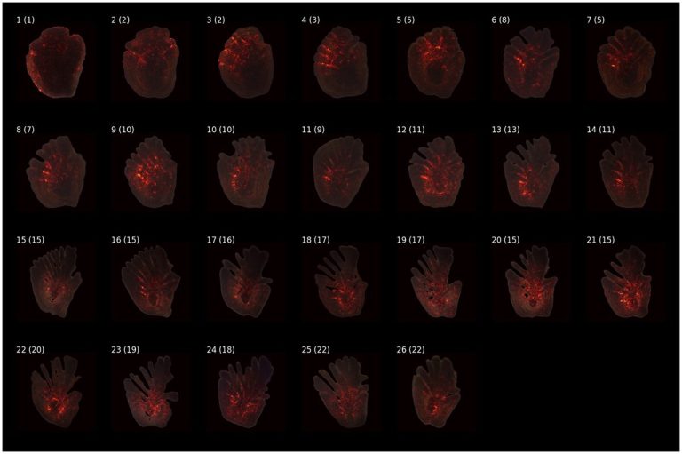 Artificial neural networks can predict age in Greenland halibut using ...