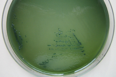 Biotech researchers say rapid test detects seafood pathogen Vibrio in ...