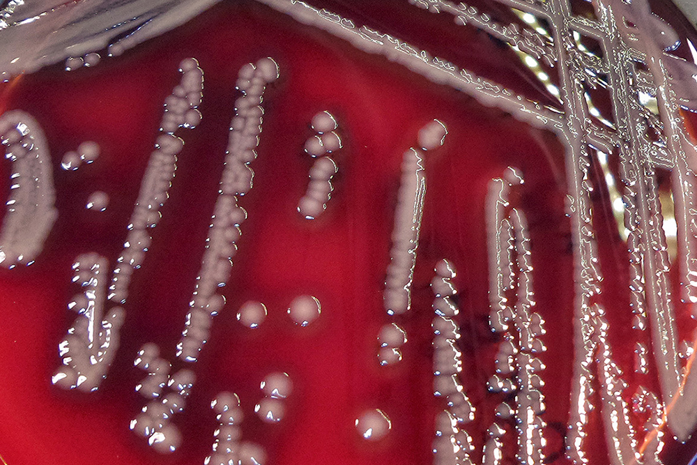 Aquaculture and Aeromonas hydrophila: A complex interplay of ...