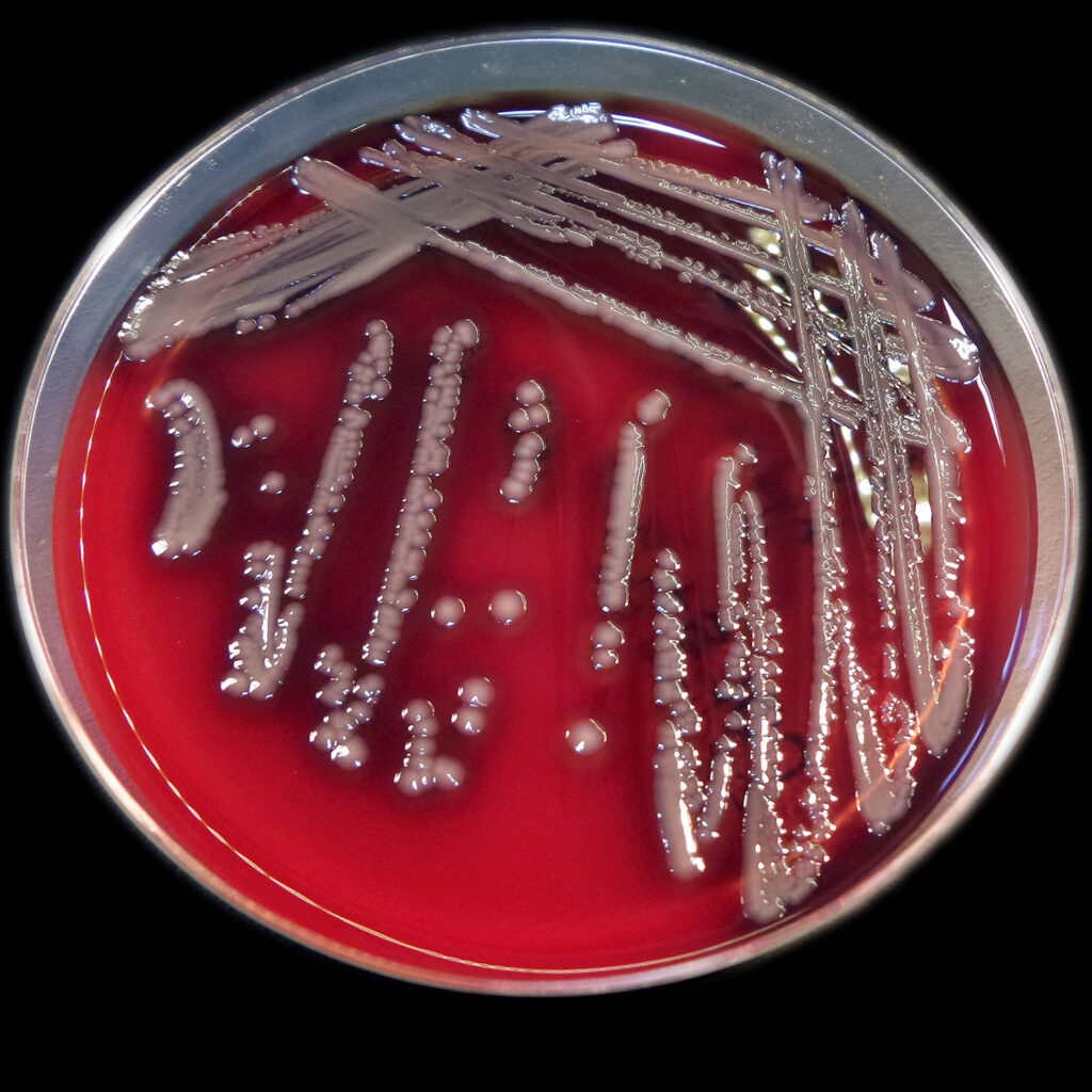 Aquaculture and Aeromonas hydrophila: A complex interplay of ...